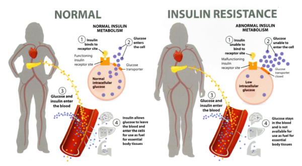 Managing Blood Sugar and Insulin Resistance - Morgan Compounding ...